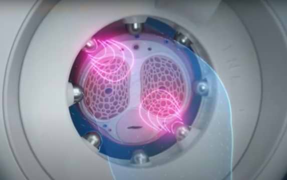 How does the Vertica® mechanism impact erectile function? - de